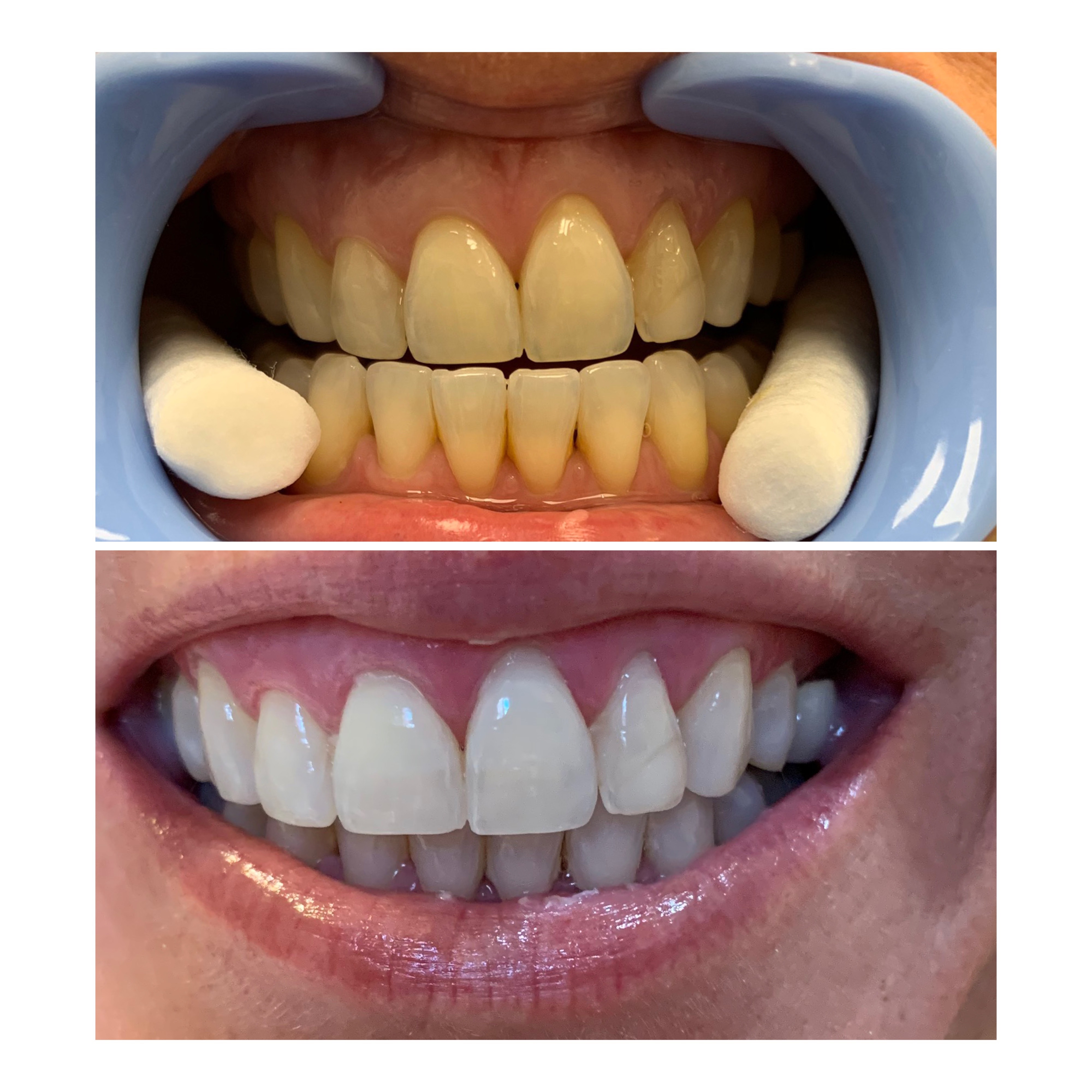 Welcome to www.RedCarpetSmilesInc.com